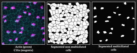 Image Segmentation Using Matlab Vignesh Aravind Project Page