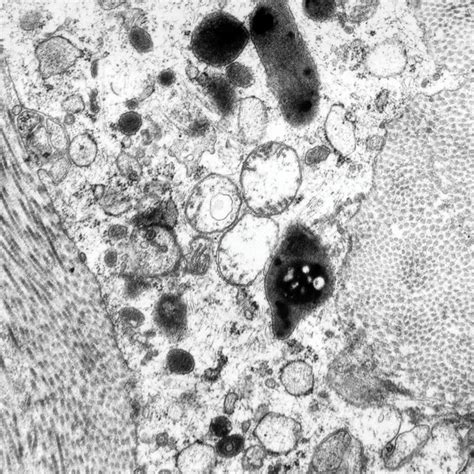 Tem Lung Parenchyma Two Type Ii Pneumocytes Surrounded By Hypophase