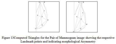Cad Based Method For Detection Of Breast Cancer Oriental Journal Of Computer Science And
