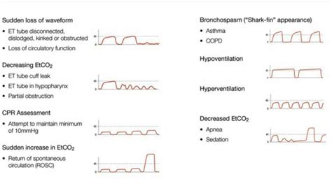 Capno Wave Explanations Respiratory Care Advanced Cardiac Life