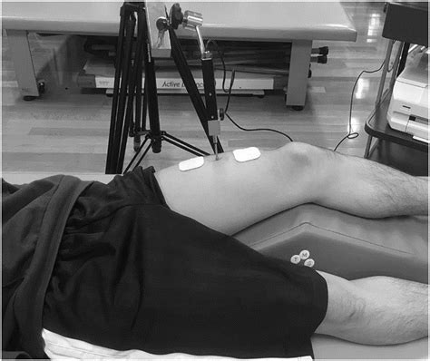 Characteristics Of Muscle Contraction Of The Rectus Femoris Using Tensiomyography By Sex In