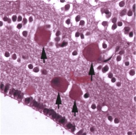 High Magnification Image Of Mesencephalic Trigeminal Cells Arrows