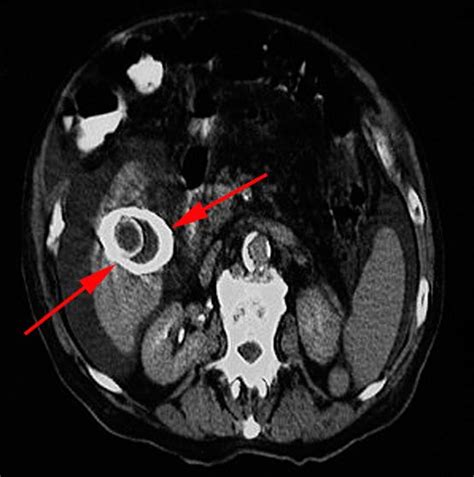 Gastrointestinal Radiology