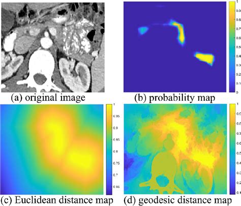 figure 4 from automatic pancreas segmentation in ct images with