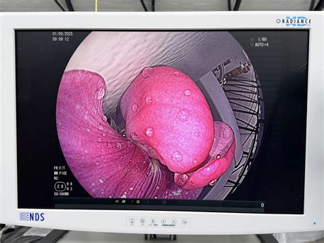 Sell Endoscopy System On Bimedis Endoscopy System Fujifilm Vp 3500hd Xl