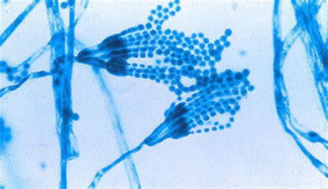 Organisms Micro Lab Final Flashcards Quizlet