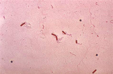 Public Domain Picture Bacillus Brevis Flagella Stain Id