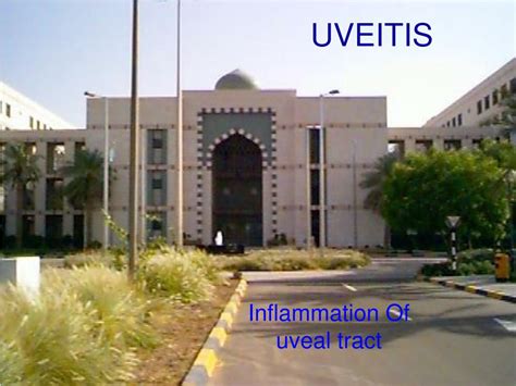 Ppt Uveitis Powerpoint Presentation Free Download Id510181