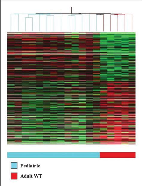 Unsupervised Hierarchical Clustering Of 13 Pediatric Gists And 5 Adult