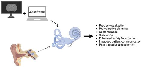 Mps Free Full Text Advances In 3d Inner Ear Reconstruction Software For Cochlear Implants A
