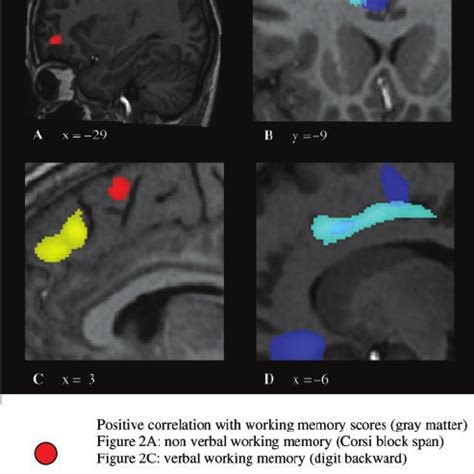 Statistical Parametric Maps Of Regression Analyses A D Download Scientific Diagram