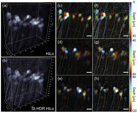 Depth Sectioned Images With The Hilo Microscopy 3d Reconstruction Of Download Scientific