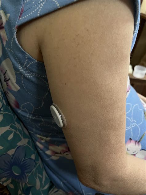 Best Freestyle Libre Images On Pholder Freestylelibre Diabetes And Diabetes T