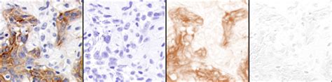 Colour Deconvolution 2 Novel Context Based Segmentation Algorithms For Intelligent Microscopy