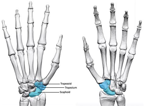 Tri Scaphoid Osteoarthritis Fife Virtual Hand Clinic