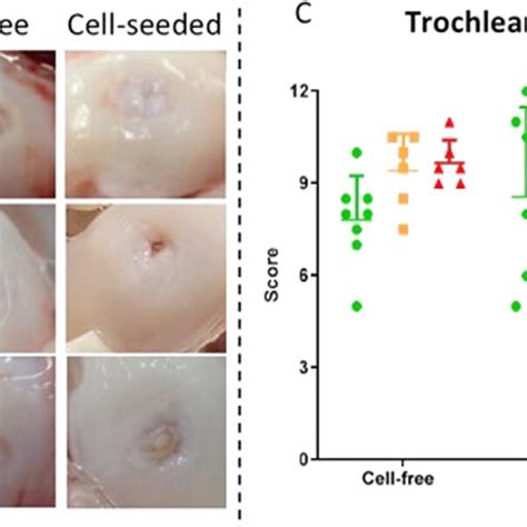 Overall Icrs Ii Scores For Femoral Condyle And Trochlear Ridge Defect