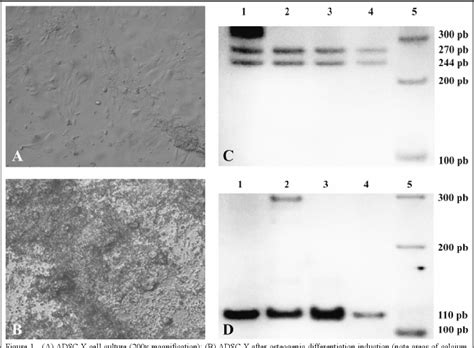 Figure 1 From Nested Pcr Multiplex Test With Increased Sensitivity For Detection Of Allogeneic