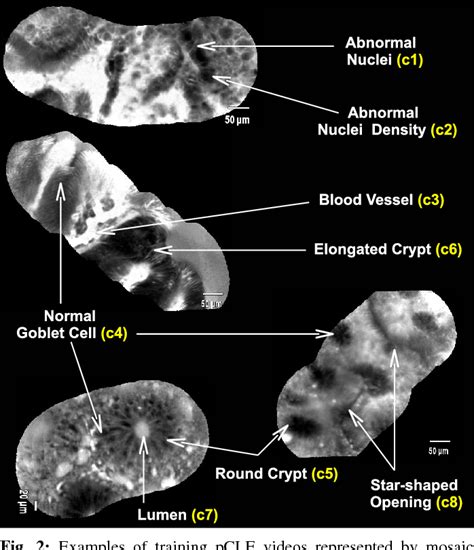 Figure 2 From Learning Semantic And Visual Similarity For Endomicroscopy Video Retrieval
