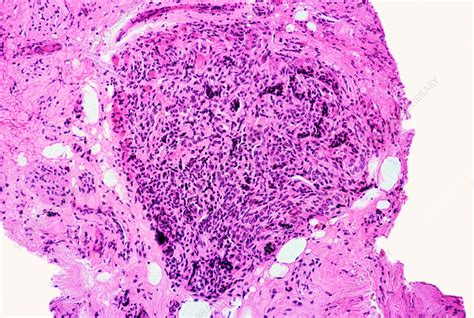 Carotid Body Light Micrograph Stock Image C0599839 Science