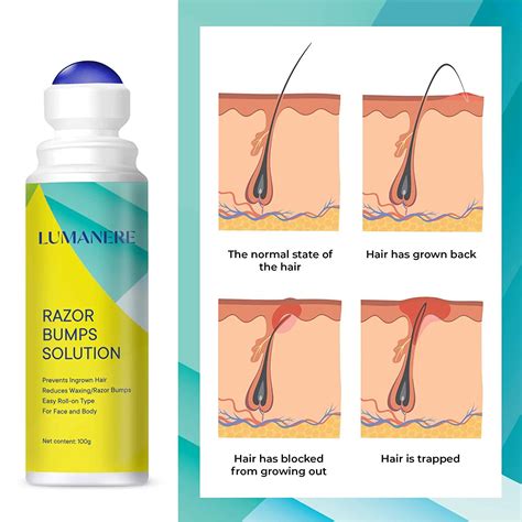 Lumanere Razor Bumps Solution Hair Inhibitor After Shave Serum Roll