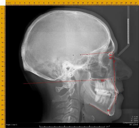 Angular Measurements Download Scientific Diagram