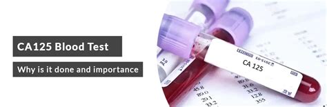 Ca 125 Test A Monitoring Tool For Ovarian Cancer Ganesh Diagnostic