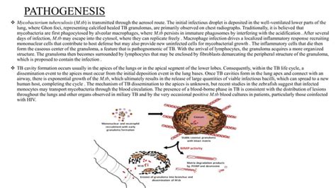 Cavitary Tuberculosis Ppt