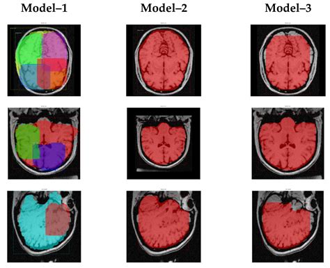 Brain Sciences Free Full Text Fully Automated Skull Stripping From