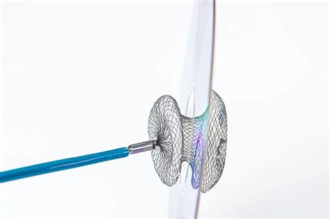 Asd Atrial Septal Defect Repair