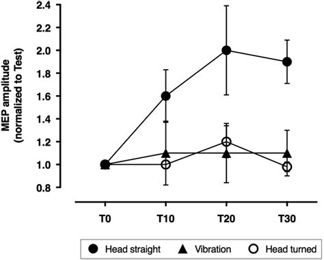 Control Experiment On Healthy Volunteers Continuous Theta Burst Download Scientific Diagram