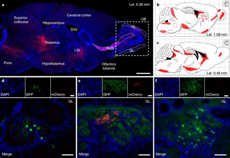 Fluorescence Microscopy Of Vsv Infected Mouse Brains A Brain Full Download Scientific Diagram