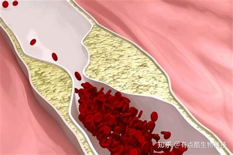 血管老化人先老干细胞可修复损伤的血管，预防改善血管老化 知乎