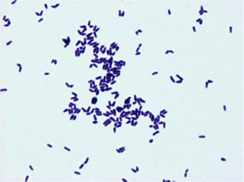 Clostridium Gram Stain