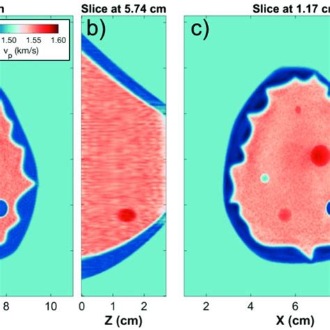 Pdf 3d Imaging Of The Breast Using Full Waveform Inversion