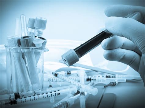 Maximizing Laboratory Efficiency By Automation A Customer Journey