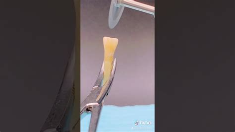 Tooth Cut In Half Youtube