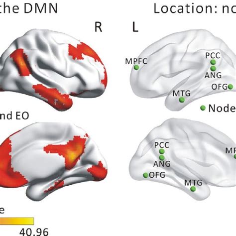 Spatial Distribution Of Temporal Correlations For The Posterior Download Scientific Diagram