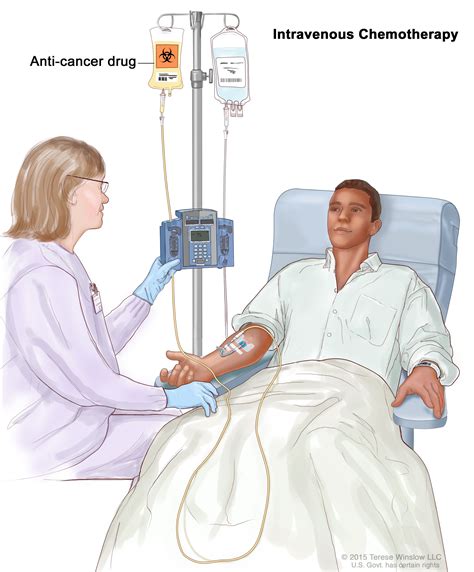 Getting Iv Or Injectable Chemotherapy