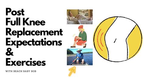 Post Knee Replacement Exercises Australia At Brittany Wertz Blog