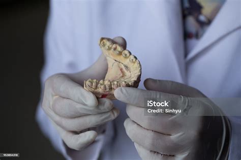 연구 진단 캐스트 및 치과 실험실에서 치과 석고 모델의 캐스팅 개방교합에 대한 스톡 사진 및 기타 이미지 개방교합 건강