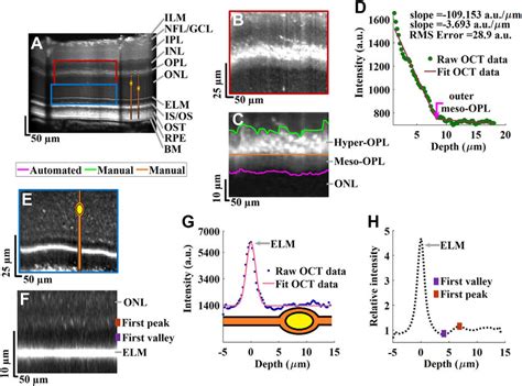 Segmentation Of Meso Outer Plexiform Layer Opl And Analysis Of Outer Download Scientific