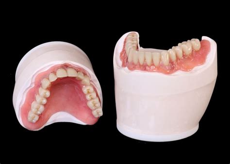Sr Nexco Paste Composite Hughes Dental Laboratory