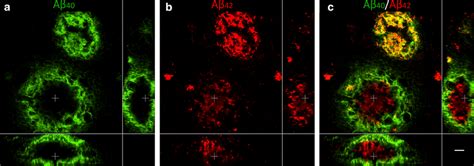 3d Composition Of Aβ40 And Aβ42 In The Coarse Grained Plaque Clsm 3d