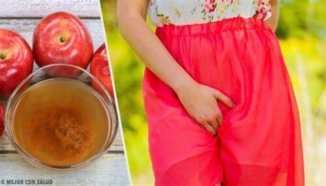 Hjemmelagde Remedier Mot Soppinfeksjon I Underlivet Veien Til Helse