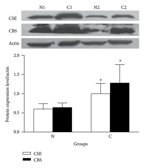 Upregulation Of Cse And Cbs Expression In Gastric Carcinoma A Tissue Download Scientific