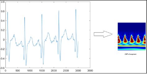Figure 3 From Single Heartbeat Ecg Biometric Recognition Using Convolutional Neural Network