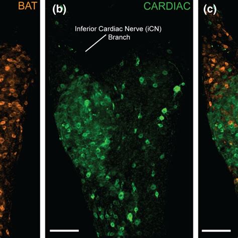 dual tracing demonstrates that bat‐ and cardiac‐projecting sg neurons