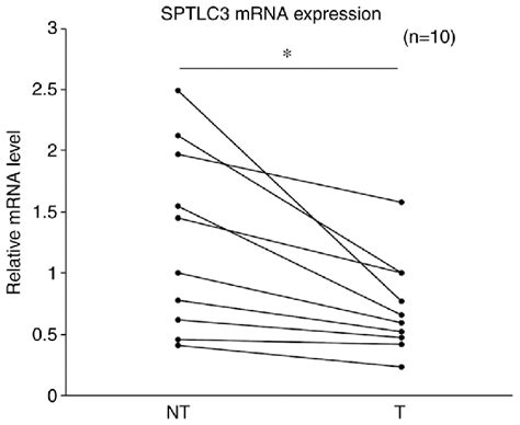 SPTLC MRNA Expression In Tumor And Non Tumor Areas Of Liver Tissues In Download Scientific