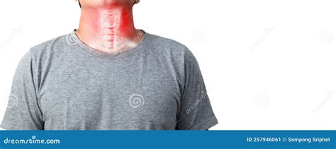 Spondylite Cervicale De Los Du Cou Inflammation De La Colonne