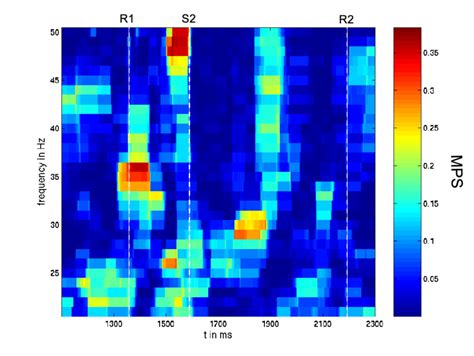 14 The Panel Shows The Gloal Phase Synchronization Index Mps In A